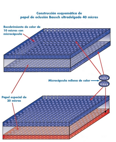 40µm – Arti-Check | Bienvenido al Blog de VK Import